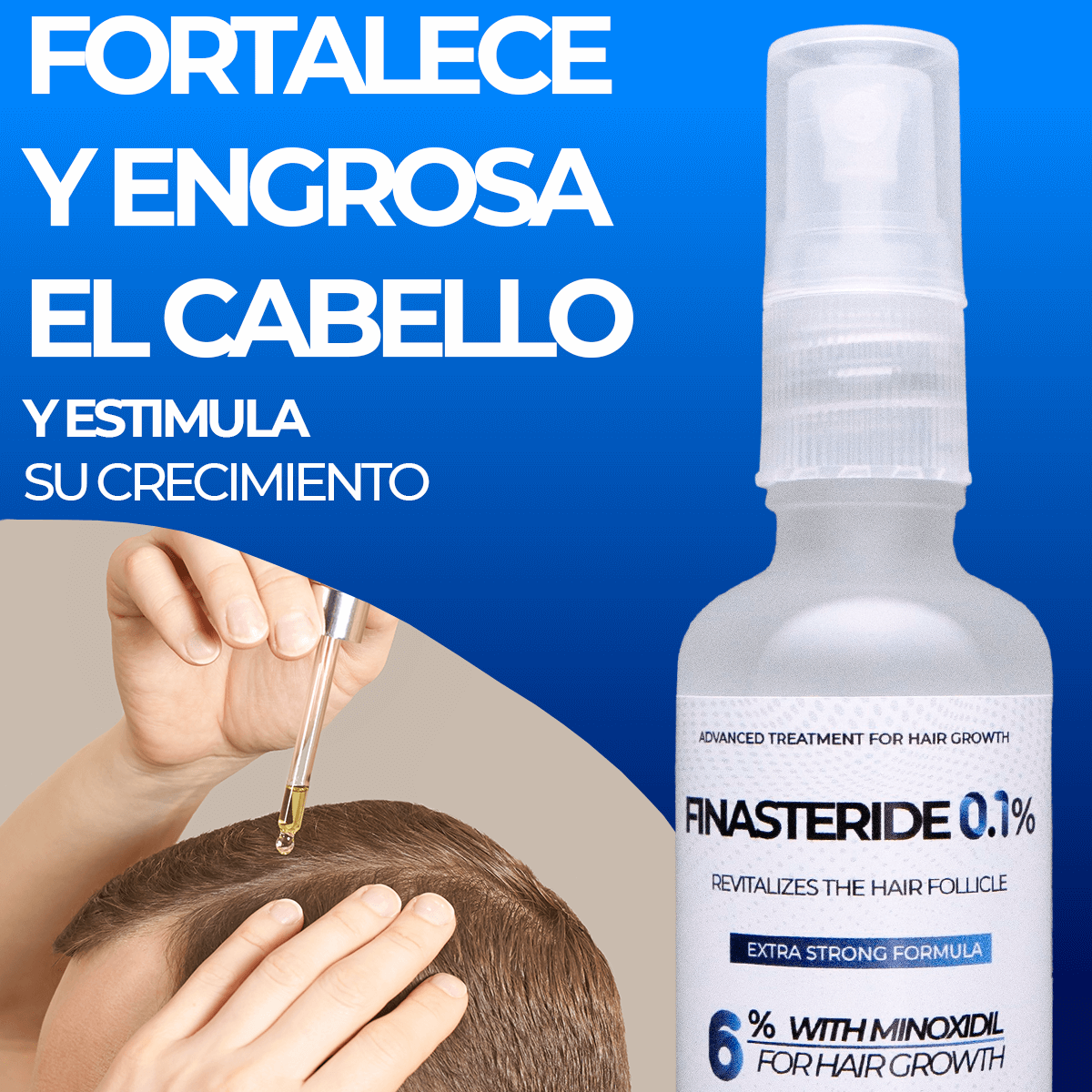 Minoxidil más Finasteride tópico 0.1% en México